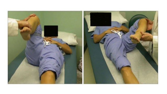 Slipped Capital Femoral Epiphysis