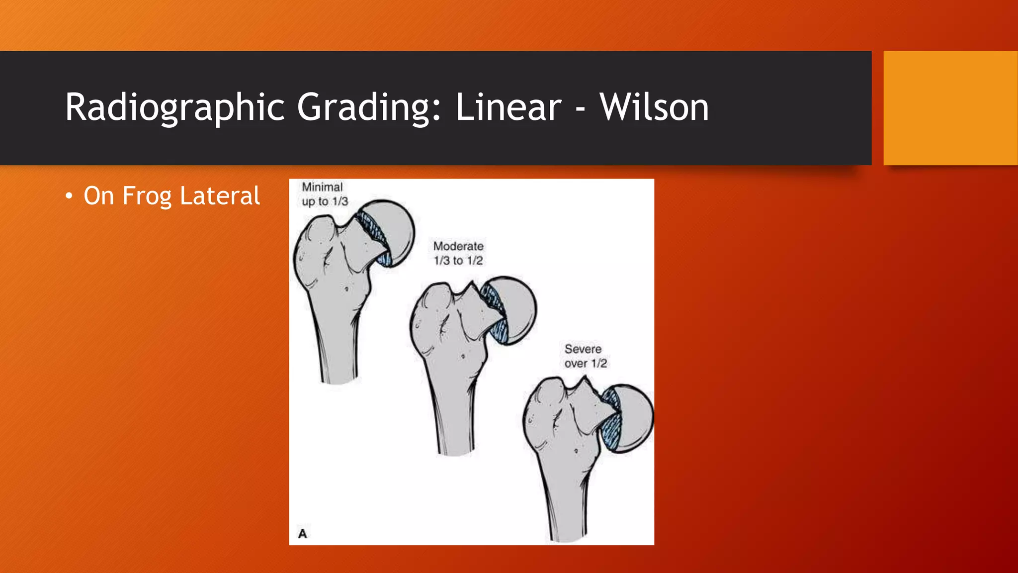 Slipped capital femoral epiphysis | PPT