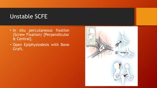Slipped capital femoral epiphysis | PPT