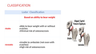 SCFE.pptx /slipped capital femoral epiphysis | PPT