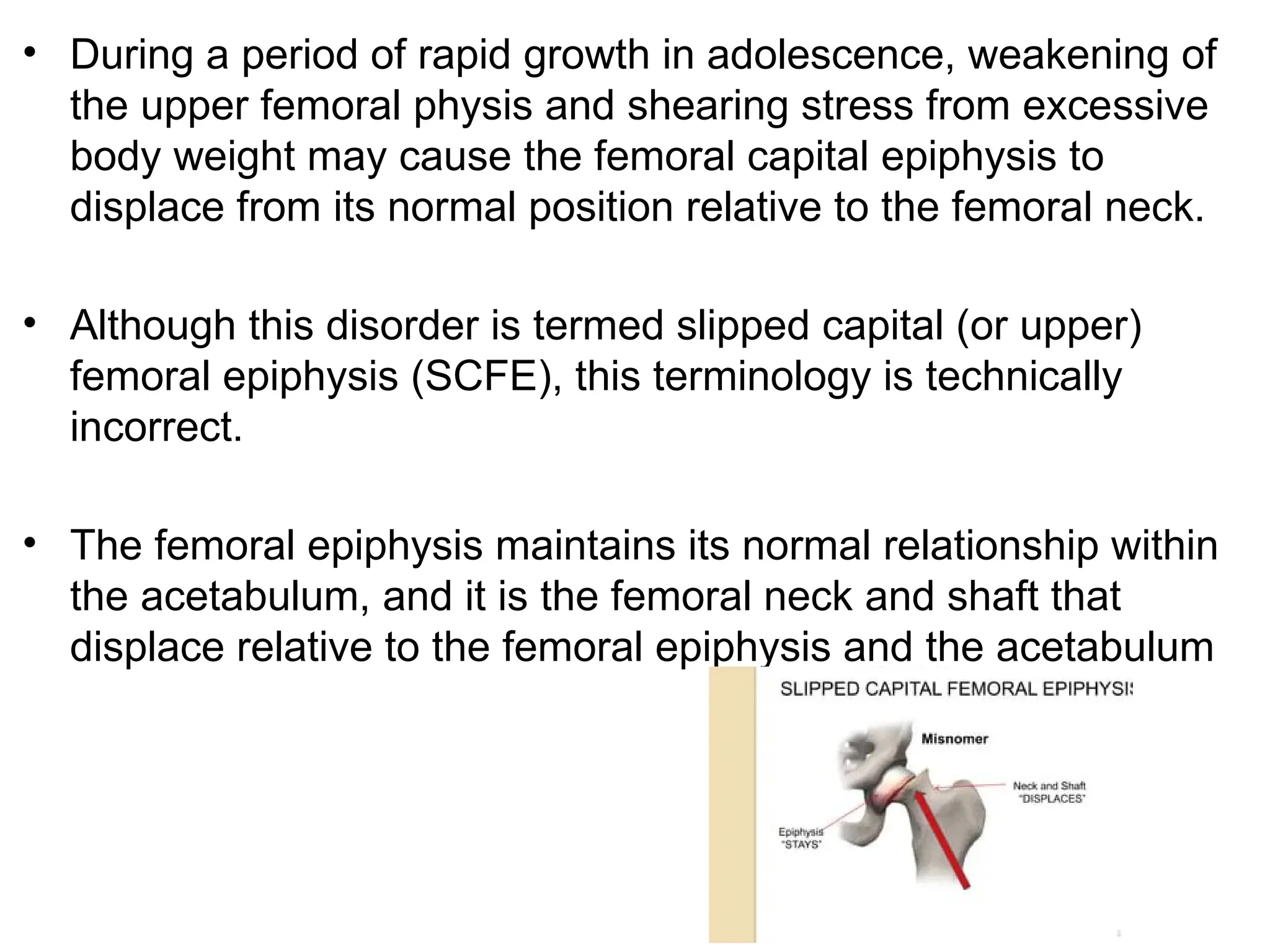 Slipped capital femoral epiphysis-Paediatric orthopaedics | PPT