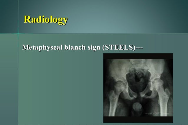SLIPPED CAPITAL FEMORAL EPIPHYSIS - By Dr. Lokesh Sharoff