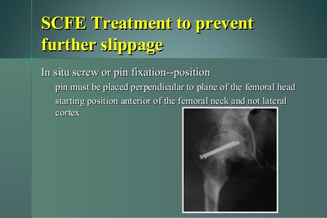 SLIPPED CAPITAL FEMORAL EPIPHYSIS - By Dr. Lokesh Sharoff