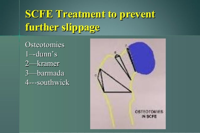 SLIPPED CAPITAL FEMORAL EPIPHYSIS - By Dr. Lokesh Sharoff