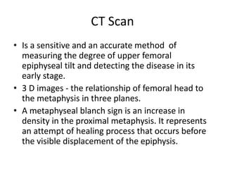 Slipped Capital Femoral Epiphysis | PPTX