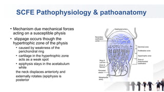 Slipped Capital Femoral Epiphysis (SCFE) DR NKUNDIMANA JEAN PAUL.pptx