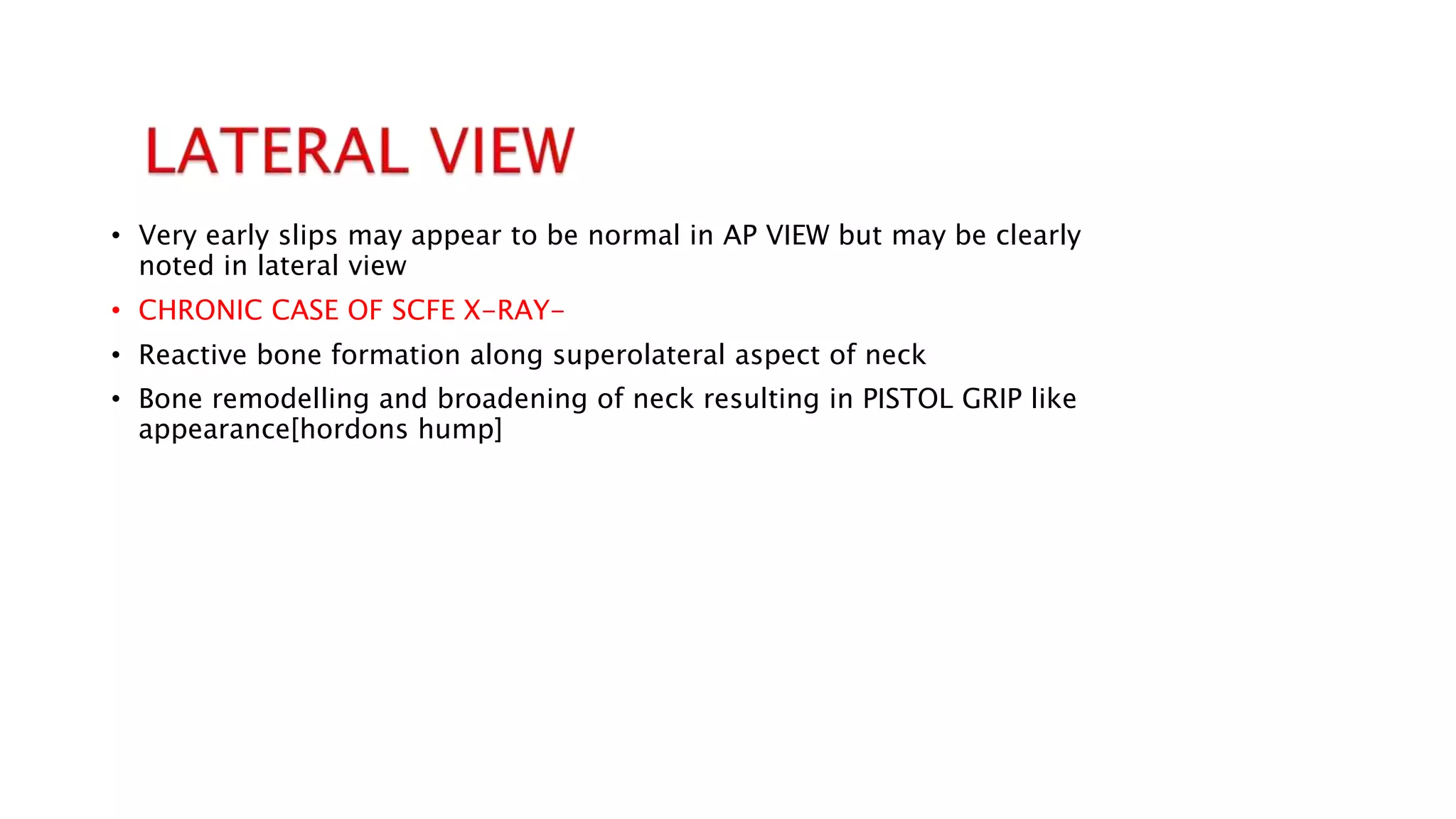 SCFE / slipped capital femoral epiphysis | PPTX