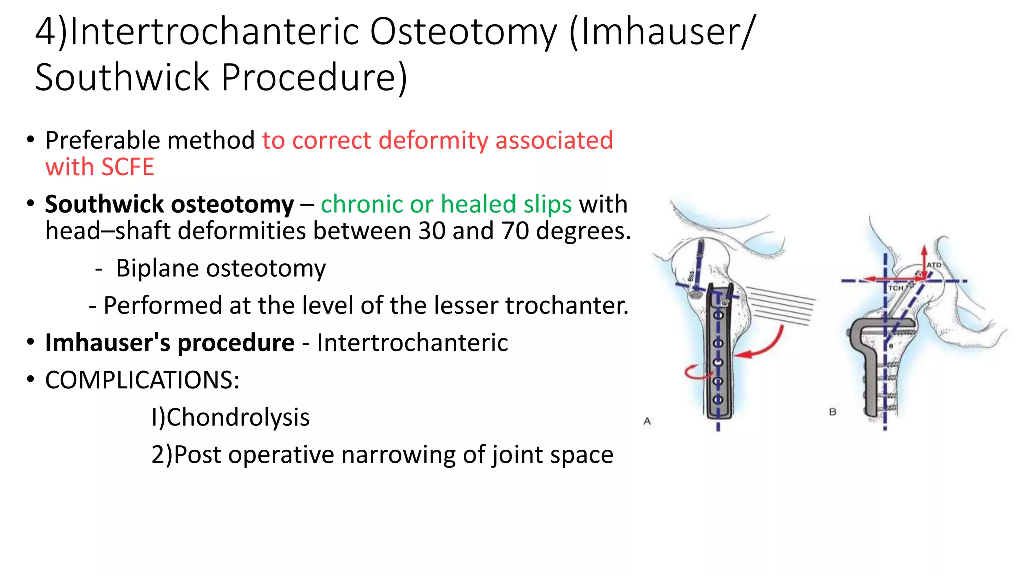 SCFE / slipped capital femoral epiphysis | PPTX