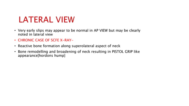 SCFE / slipped capital femoral epiphysis | PPTX | Bone and Joint ...