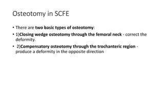 SCFE / slipped capital femoral epiphysis | PPTX | Bone and Joint ...