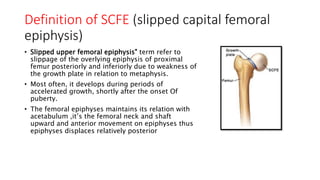 SCFE / slipped capital femoral epiphysis | PPTX
