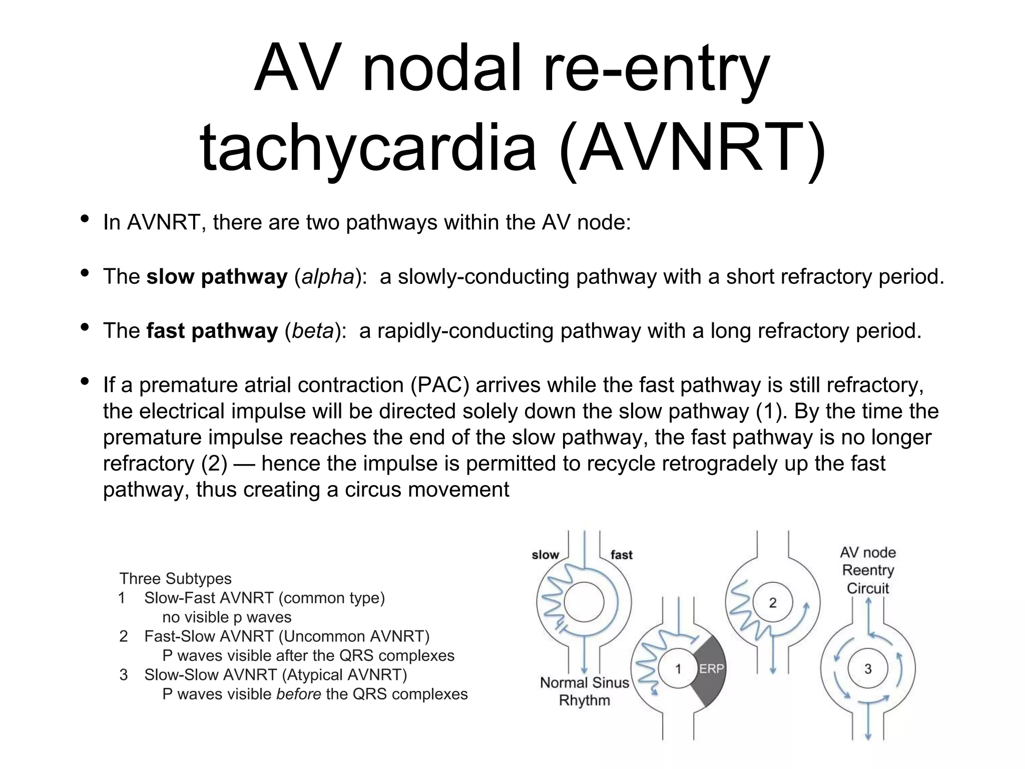 ECG Analysis | PPTX