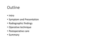 Sch 33 surgical approach to falcine meningioma | PPT