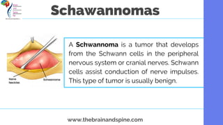 Schwannoma: An Overview | PDF