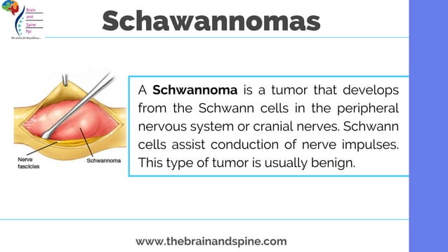 Schwannoma: An Overview | PDF | Brain and Nervous System Disorders ...