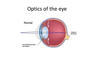 Schematic eye | PPTX