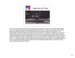 Schematic eye (2016) | PPT