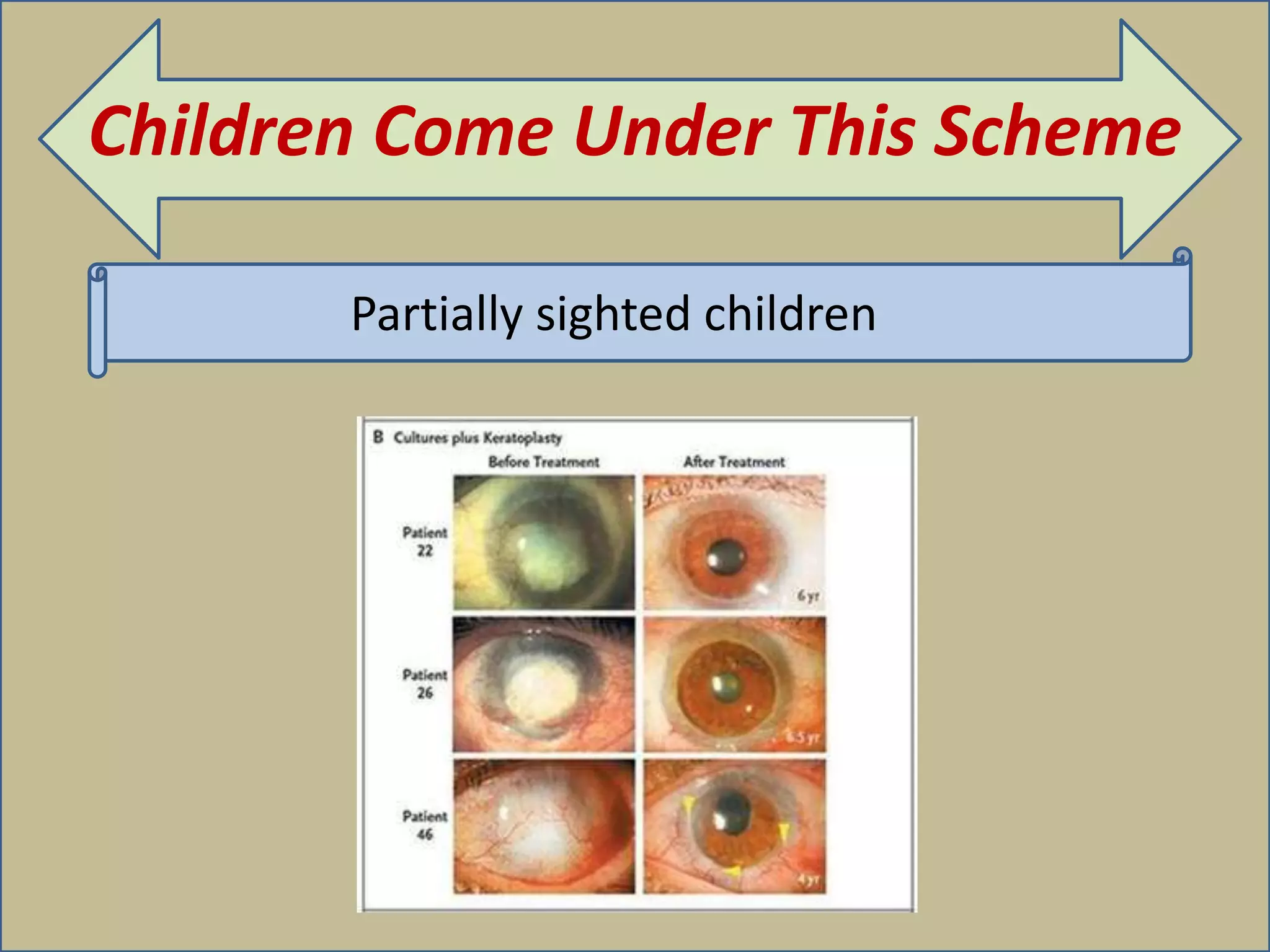 Scheme of integrated education for disabled children | PPTX