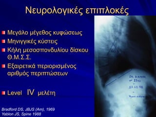 Scheuermann Kyphosis | PPT