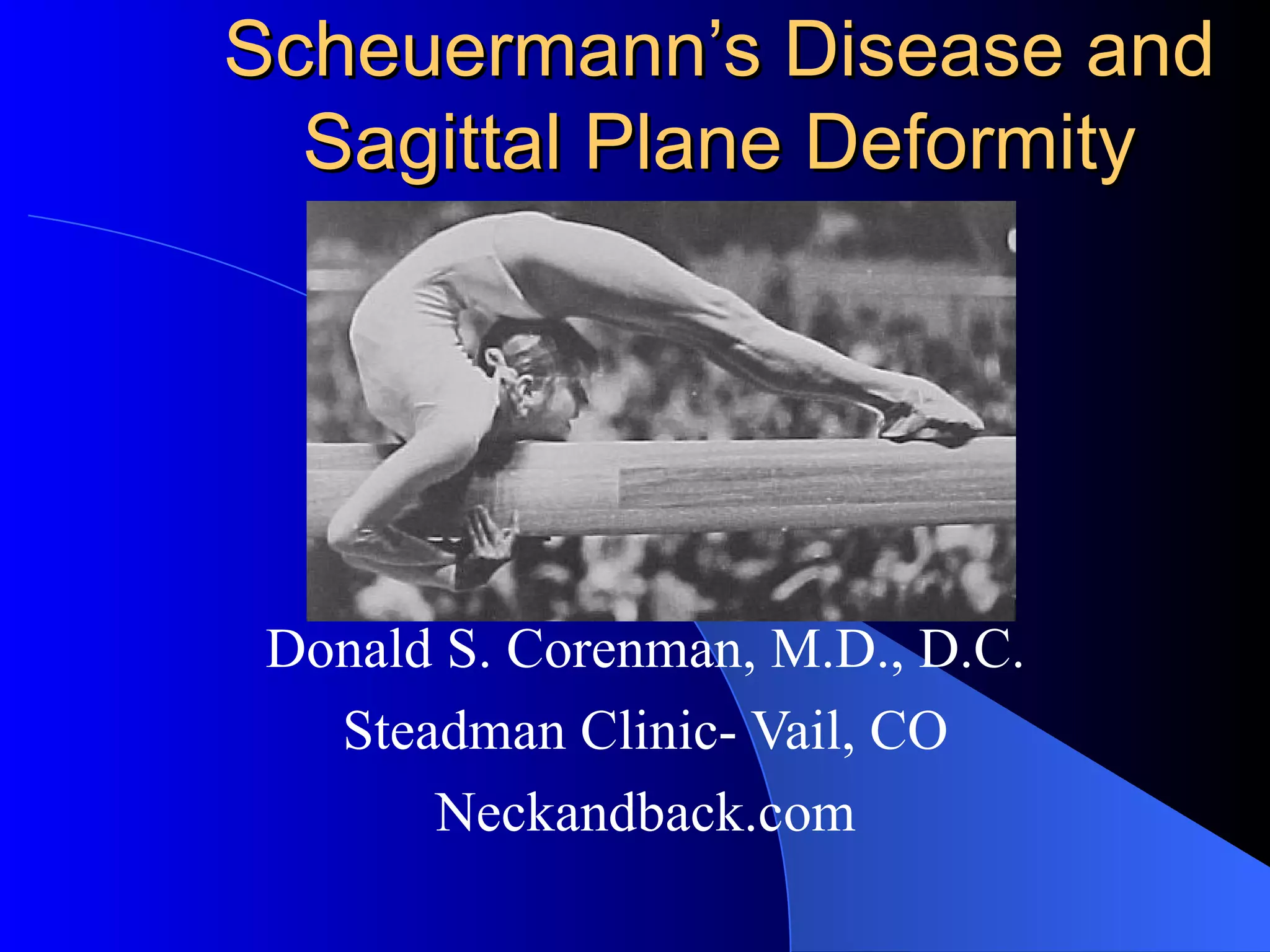Scheuermann’s disease | sagittal plane deformity | curvature of the ...