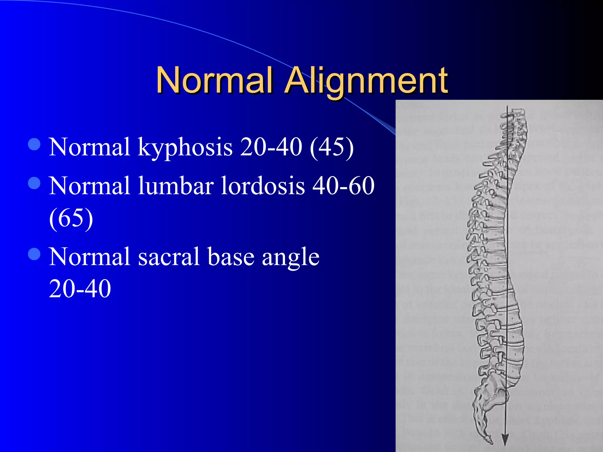 Scheuermann’s disease | sagittal plane deformity | curvature of the ...