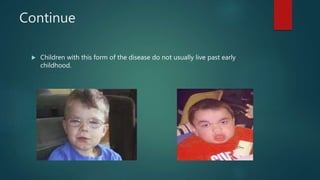 Schindler's disease | PPTX