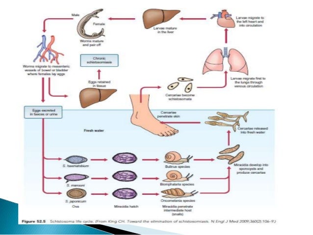 Schistosomiasis