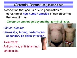 Schistosoma parasitology kasr el Einy department | PPT