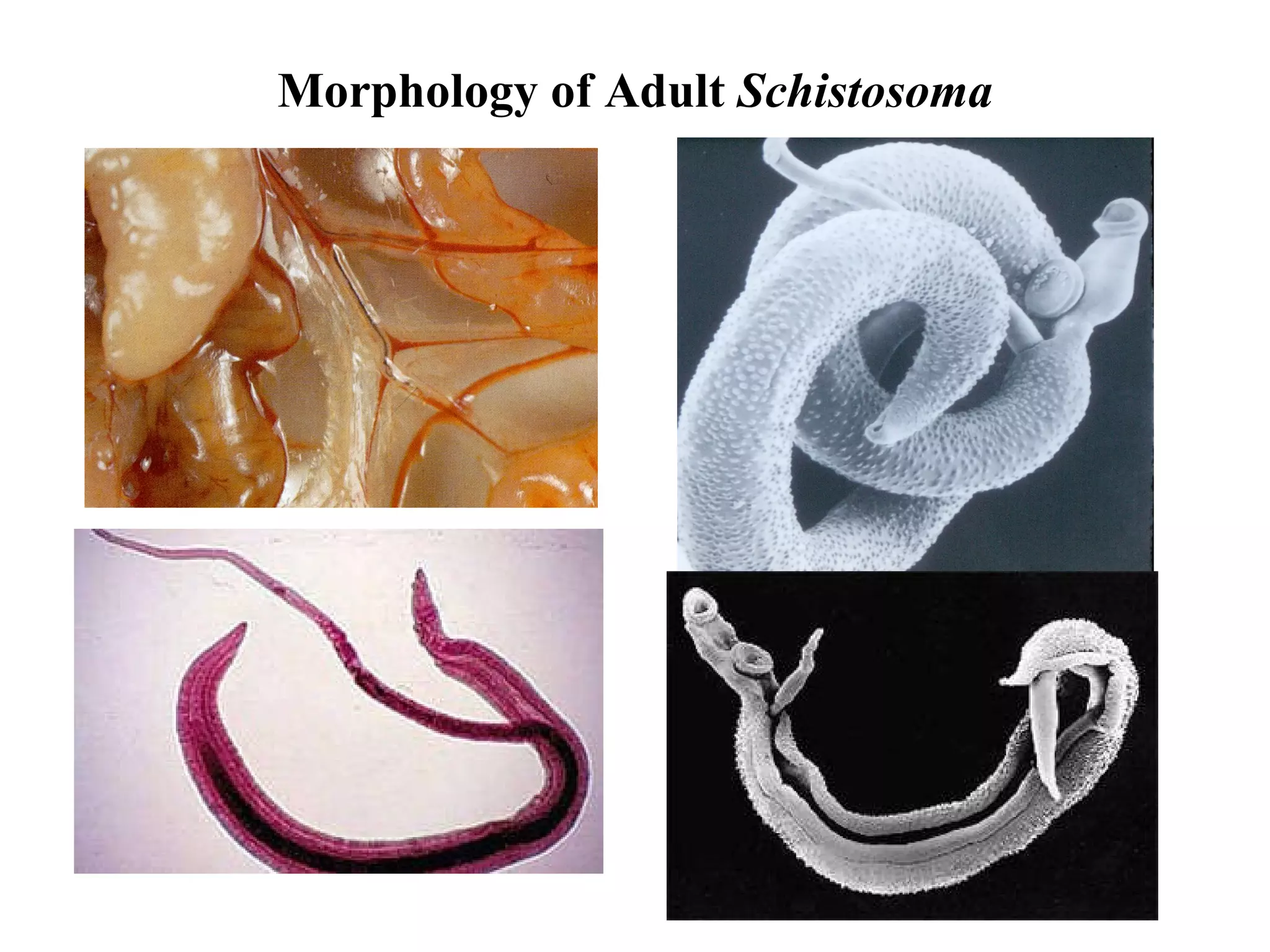 Schistosomes | PPT