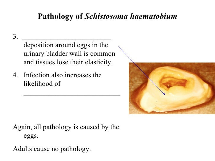 Schistosity Definition