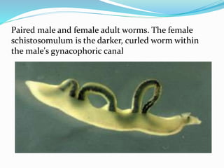 Schistosomiasis | PPTX