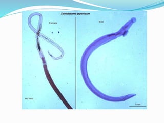 Schistosoma Haematobium Diagram