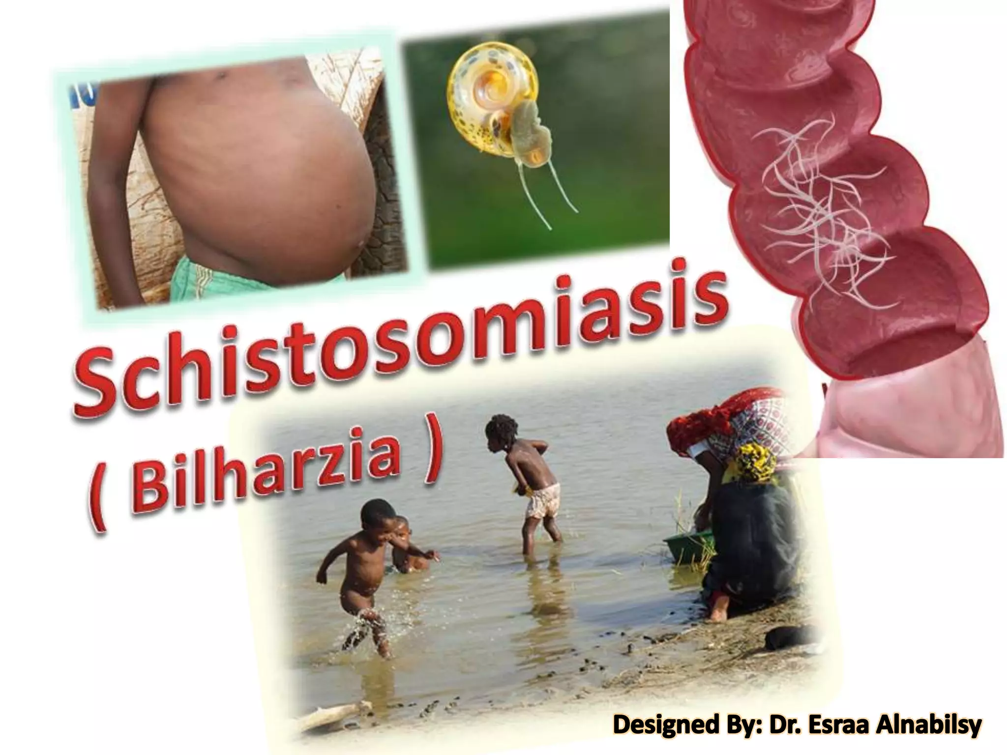 Schistosomiasis | PPTX