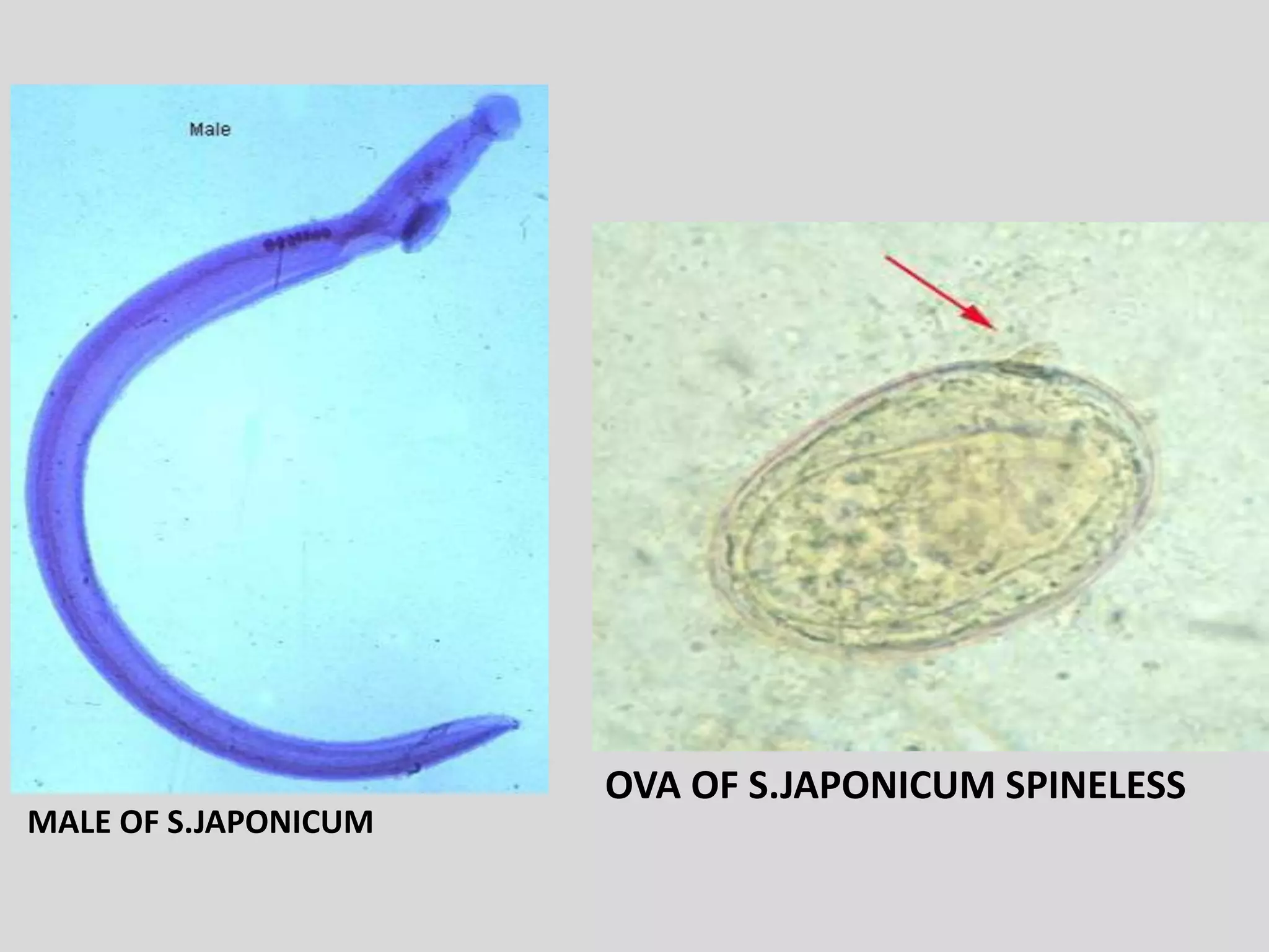 Neglected tropical diseases - Schistosomiasis (bilharzia) | PPTX