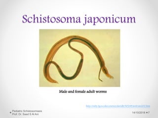 Schistosoma Haematobium Adult