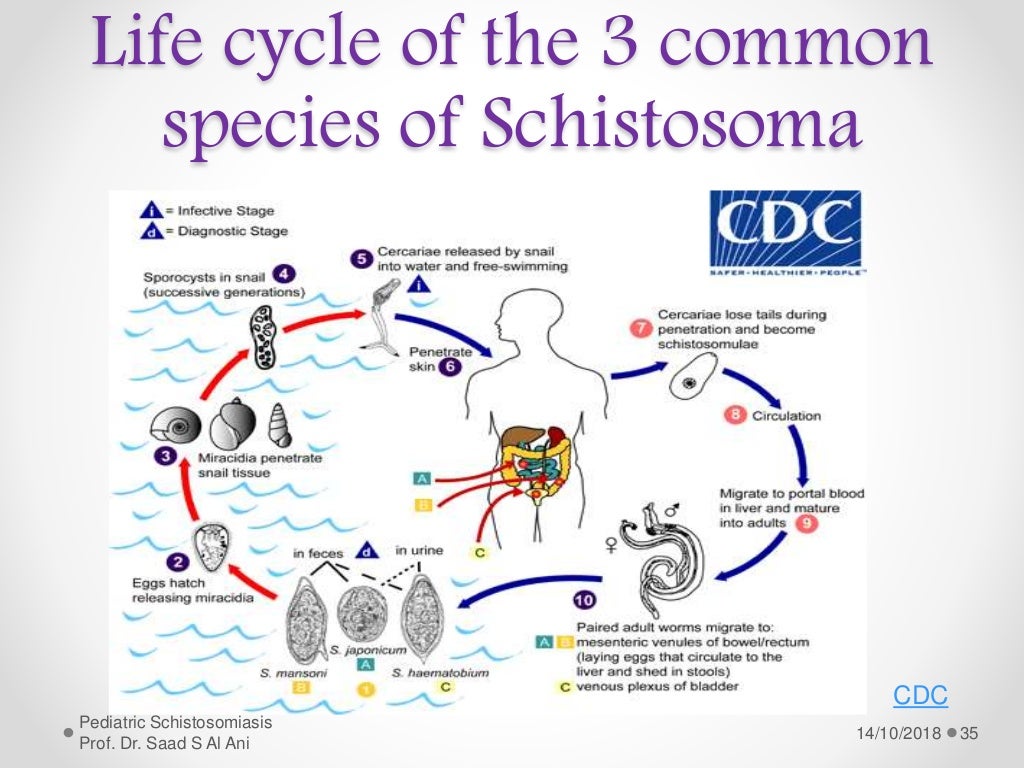 Schistosomiasis