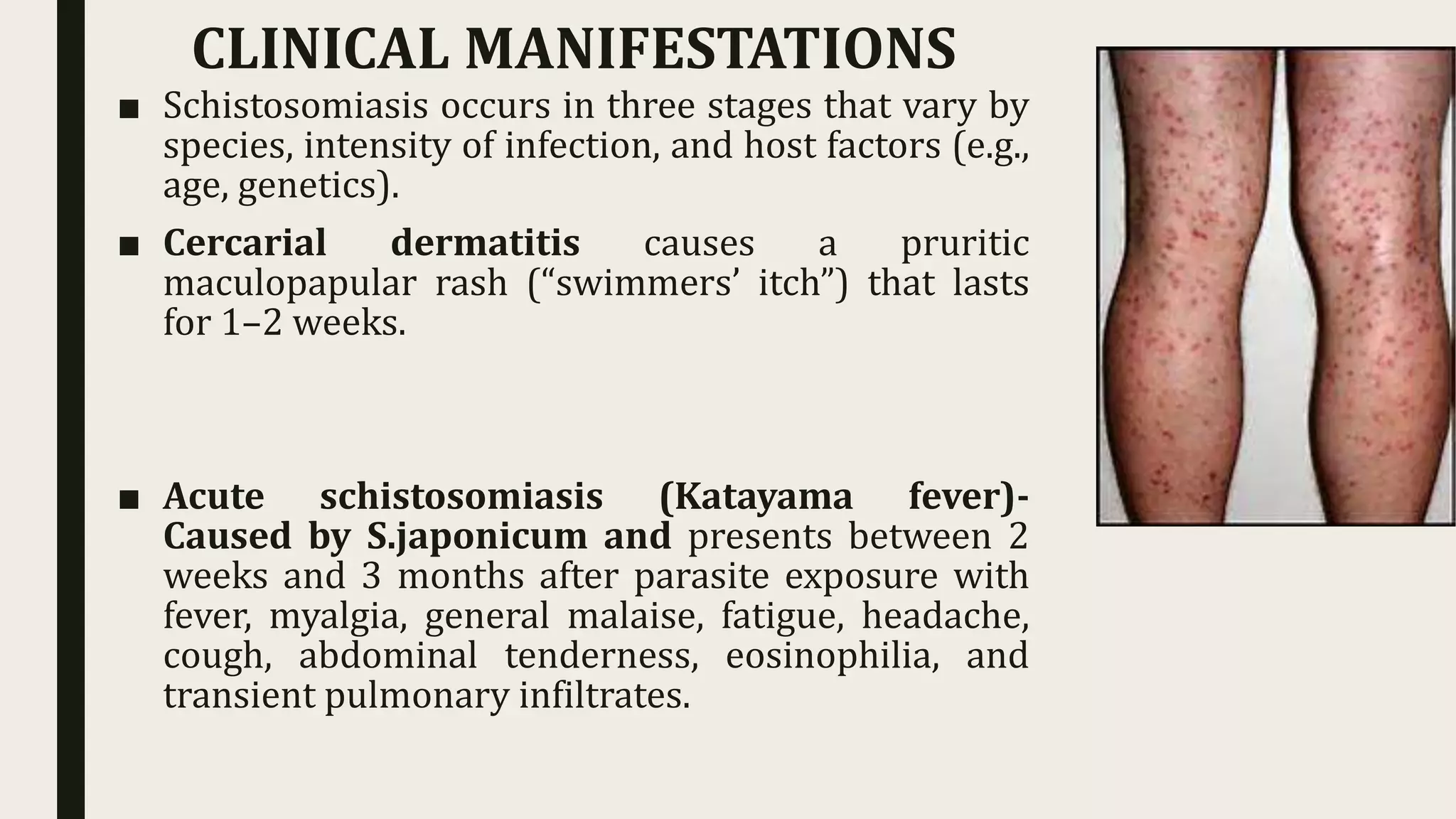 Schistosomiasis.pptx