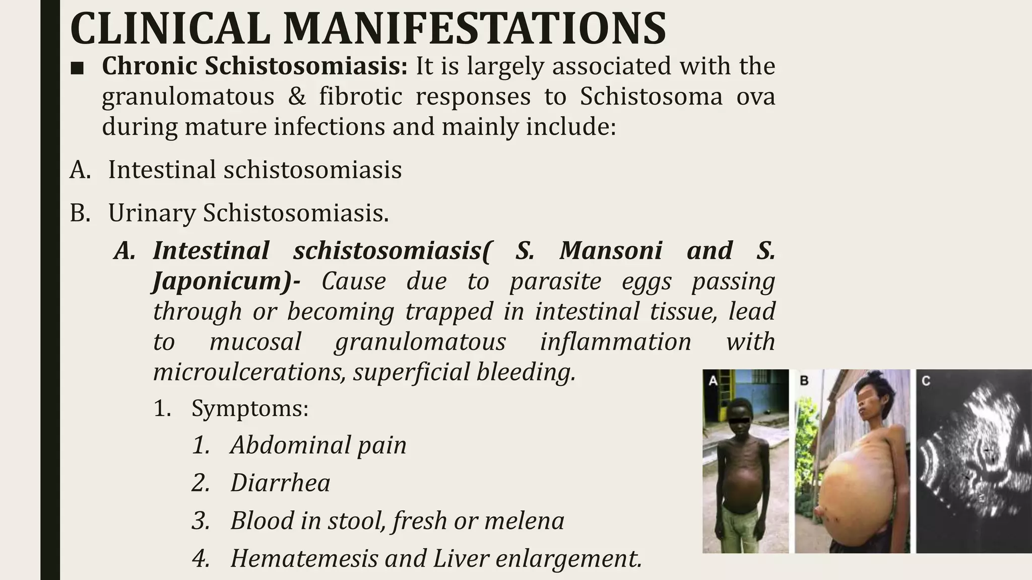Schistosomiasis.pptx