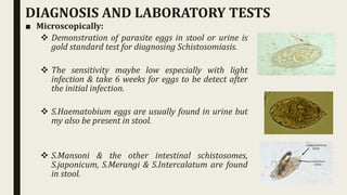 Schistosomiasis.pptx