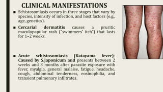 Schistosomiasis Rash