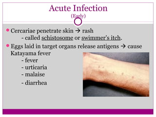 Schistosomiasis Rash
