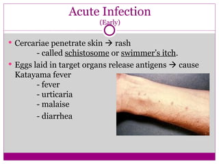 urologic aspects of schistosomiasis_97_0 | PPT