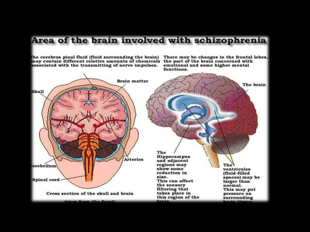 Schizophrenia | PPTX | Brain and Nervous System Disorders | Diseases ...
