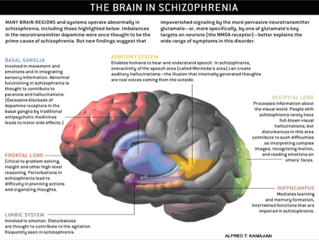 Schizophrenia