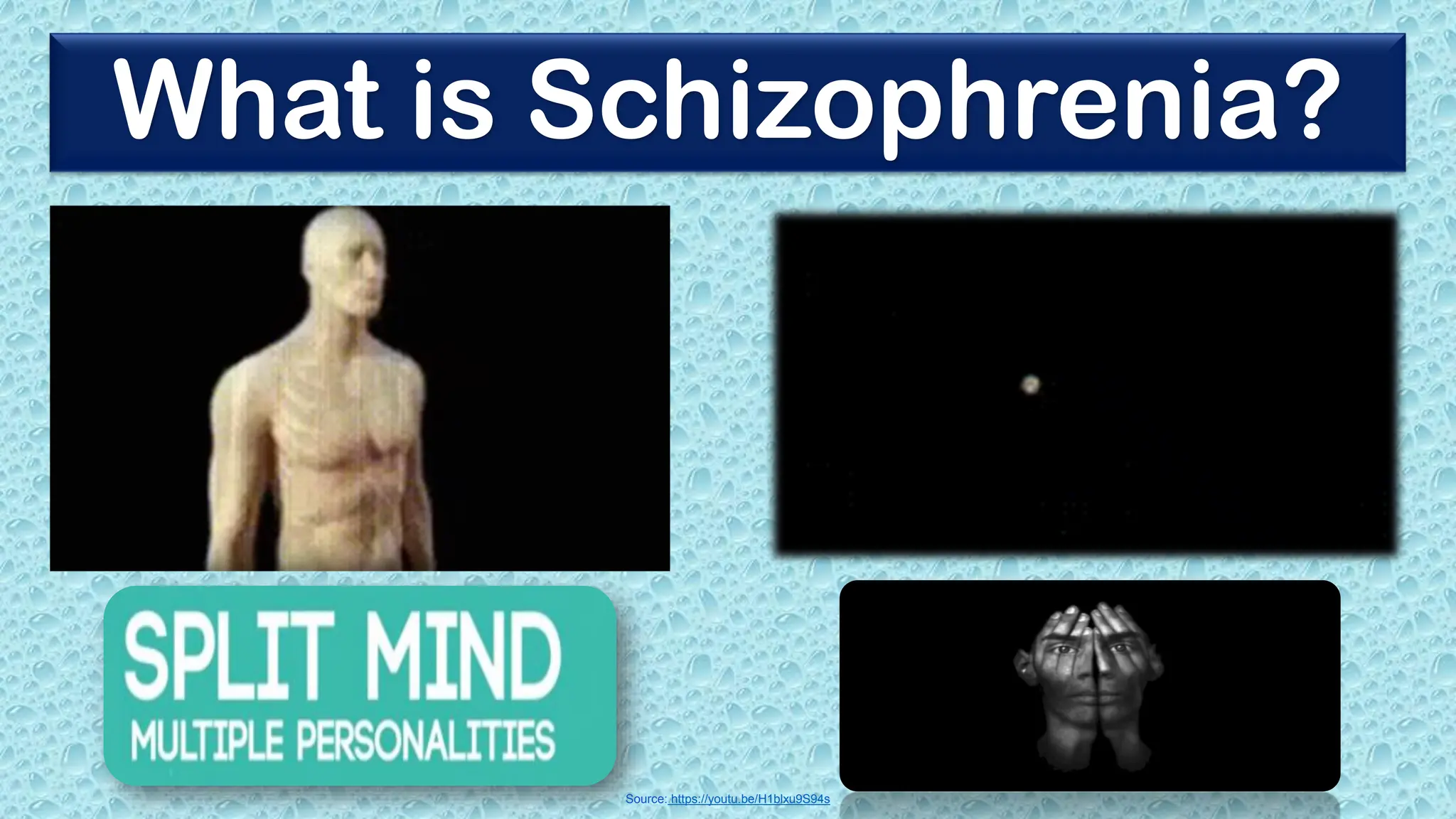 SCHIZOPHRENIA Disorder/ Brain Disorder.pdf