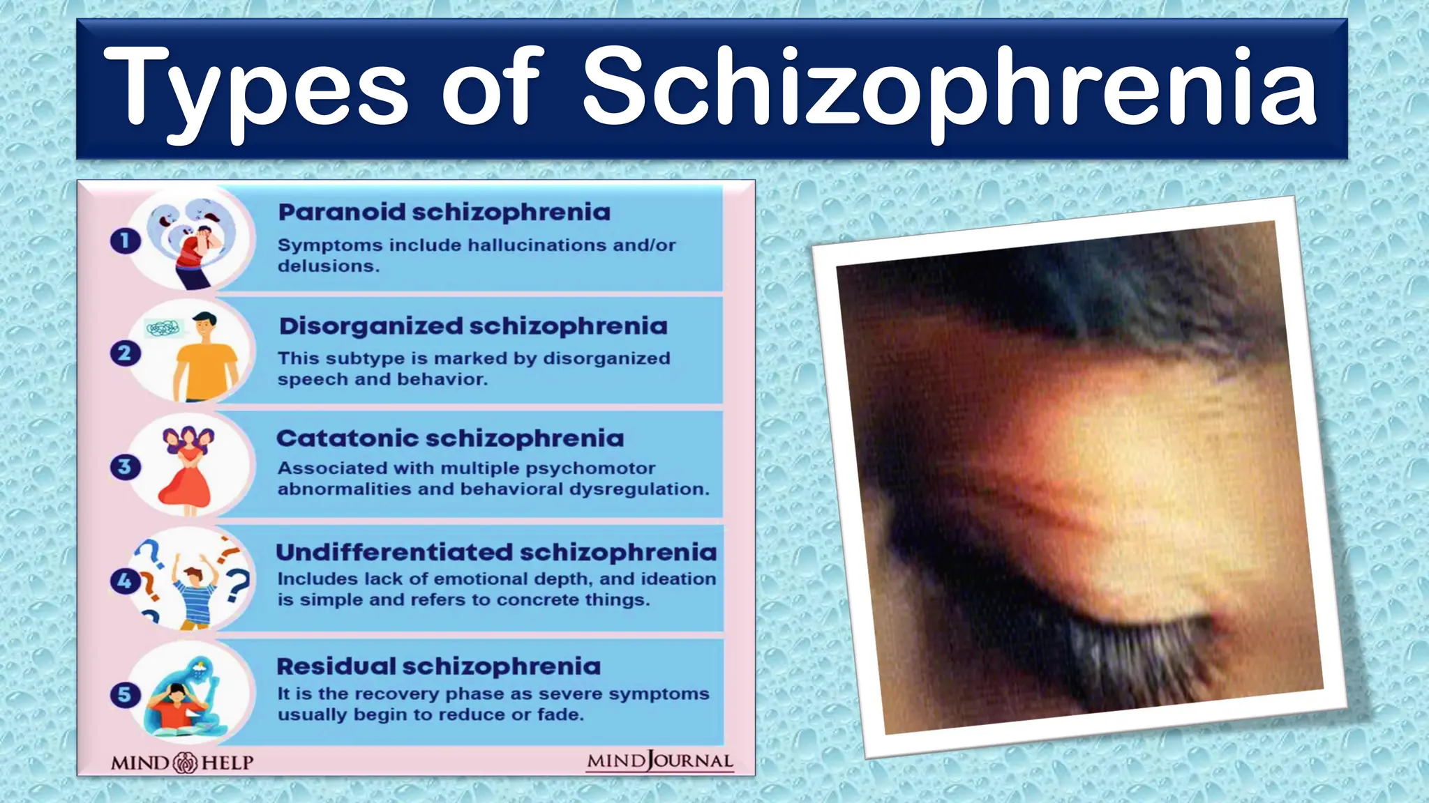 SCHIZOPHRENIA Disorder/ Brain Disorder.pdf