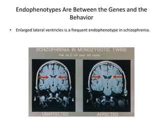 Schizophrenia as a multifactorial disorder | PPTX