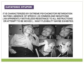 Schizophrenia Seminar Presentation | PPTX