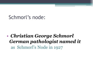 Schmorl’s node case presentation | PPT