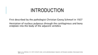 Schmorl's Nodes | PPT